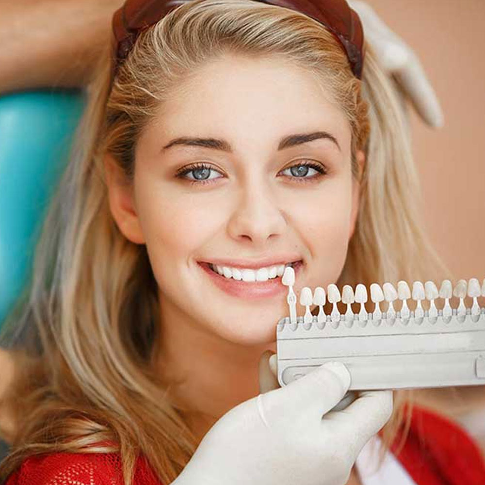 White Composite Fillings | Tooth Coloured Fillings | Birmingham